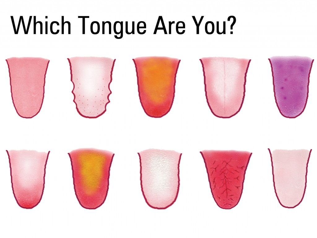 tongue chart postcard(blank) copy - AcuMedic Clinic